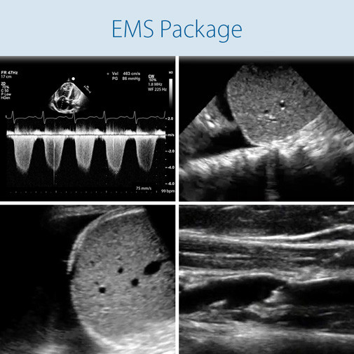 Ultrasound Training - FAST Ultrasound