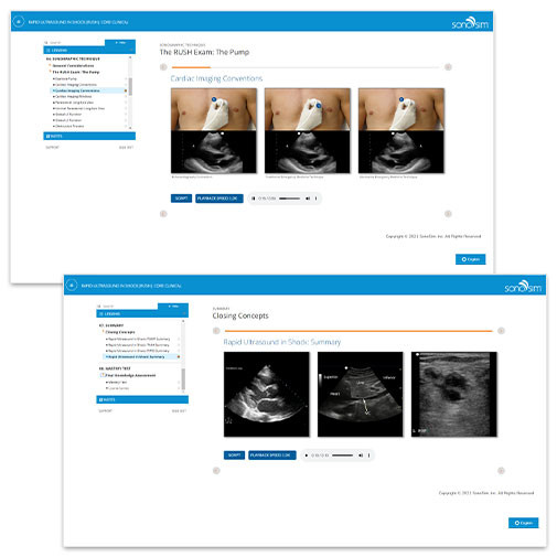 RUSH Protocol Training - Rapid Ultrasound in Shock Protocol