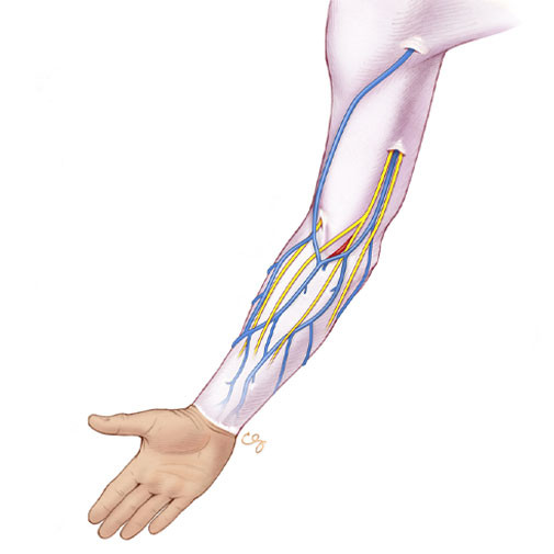 Peripheral Venous Access - Ultrasound-Guided Procedure Training
