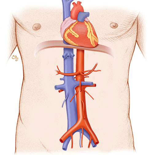 Ultrasound Training - Inferior Vena Cava (IVC) and Aorta Anatomy