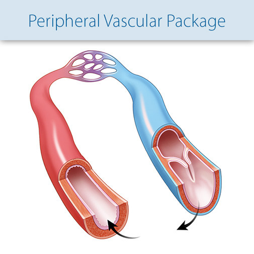 Vascular Ultrasound Training - Peripheral Vascular Disease Ultrasound
