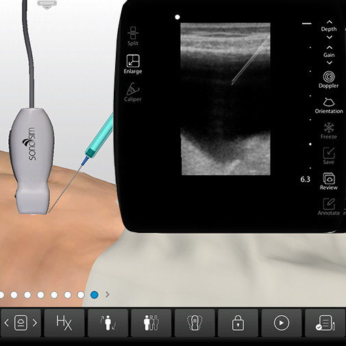 Paracentesis Procedure Training - Ultrasound-Guided Technique