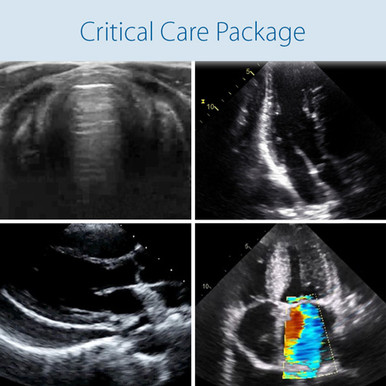 Ultrasound Training - POCUS Training - Critical Care