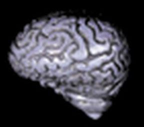 Brain Prop