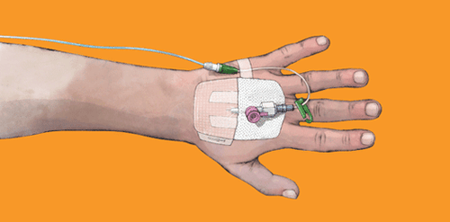 Buy Online IV3000 ONE HAND PORTED FIXATION Dressing 5CM X 6CM SN ...