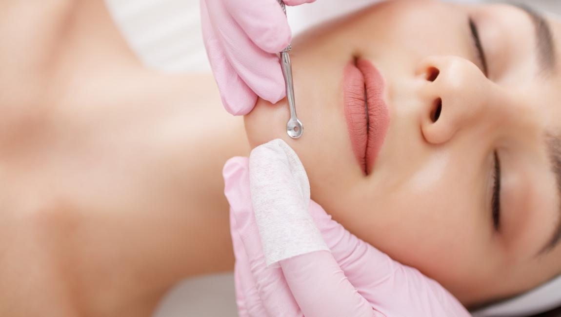 How to Get Rid of Blackheads: Tips for Achieving Clear Pores with K ...