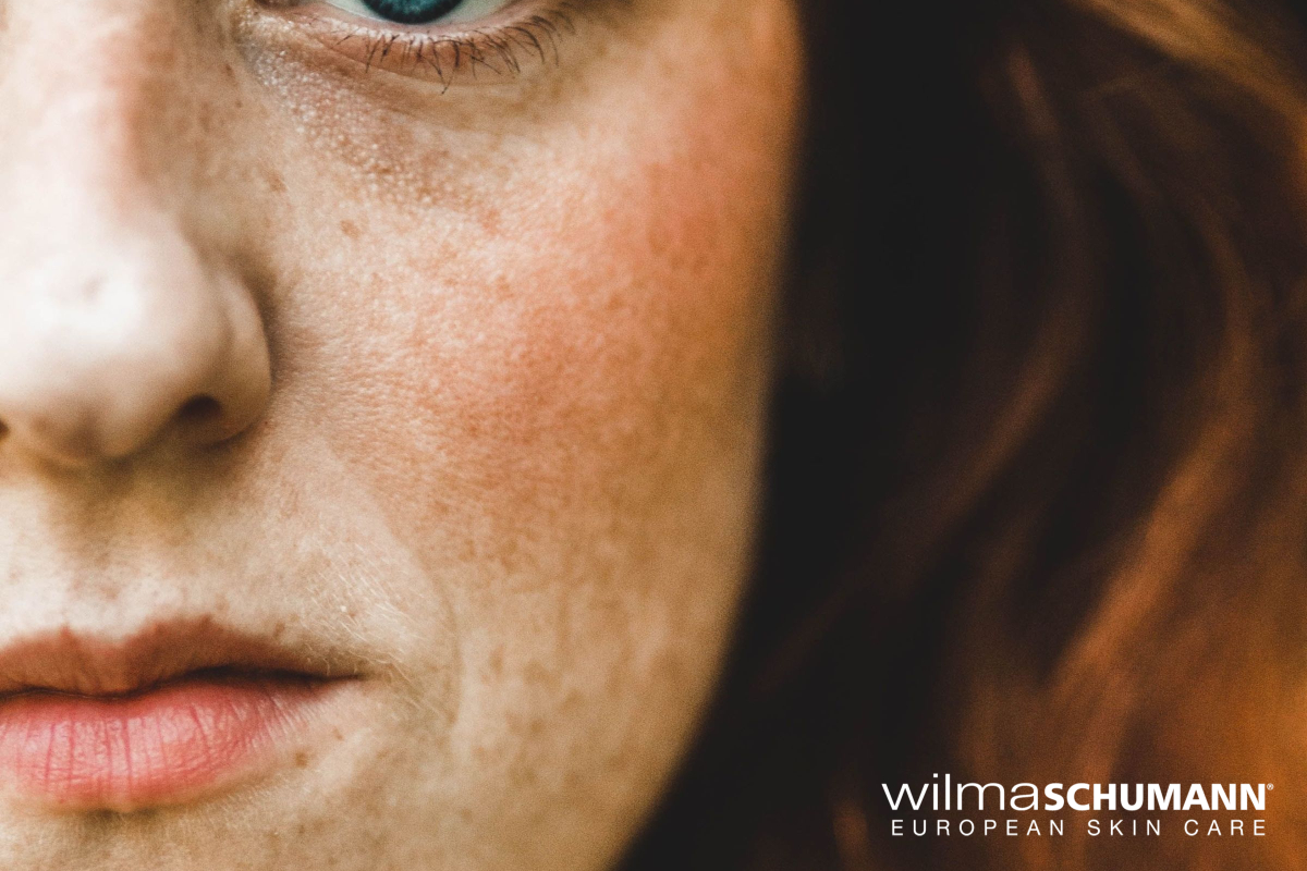 Signs You're Not Exfoliating Enough - Wilma Schumann Skin Care