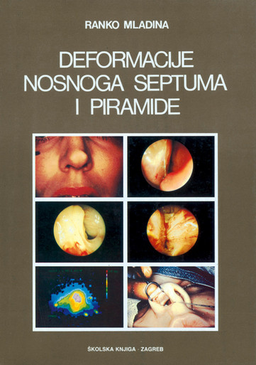 Deformacija nosnoga septuma i piramide - Školska knjiga webshop