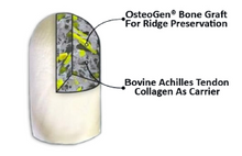 Puragraft Osteogen Plug, 10mmx20mm, Large, 10/bx | Optimus Dental Supply