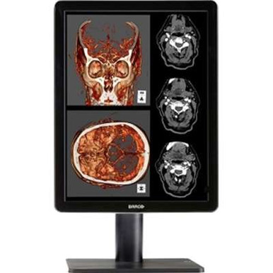 DeltaTechSol.com: Barco K9601780 Nio C 3MP 21 inch 1H1F Excludes Video ...