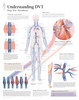 Deep Vein Thrombosis DVT Poster - Clinical Charts and Supplies