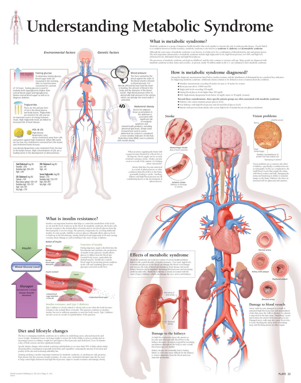 Metabolic Syndrome Poster - Clinical Charts and Supplies