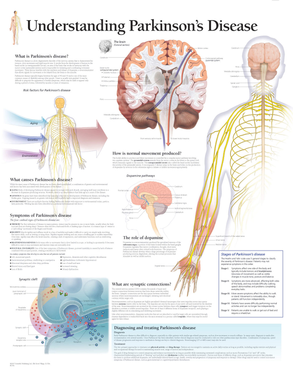 Parkinsons Poster - Clinical Charts and Supplies