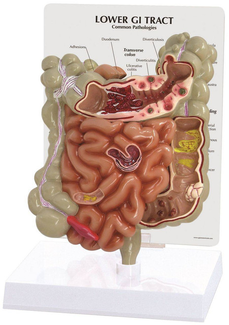 Models of the Human Digestive System | ClinicalCharts.com