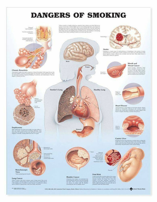 First Aid / Drug Posters - Smoking - Clinical Charts and Supplies