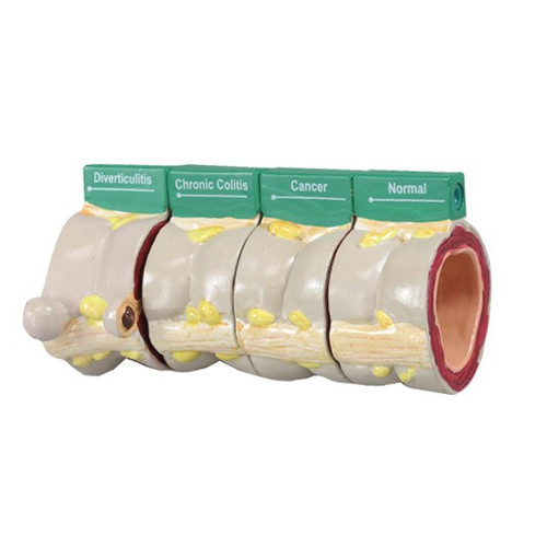 Anatomical Models-Digestive System, Colon, Stomach