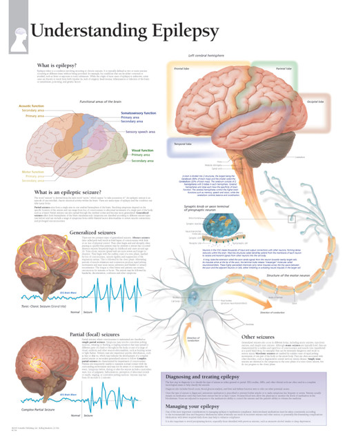 Epilepsy Poster - Clinical Charts and Supplies