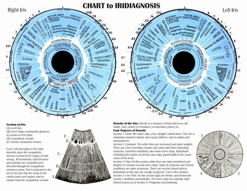 Iridiagnosis Iridology Chart with Book on CD - Clinical Charts and Supplies