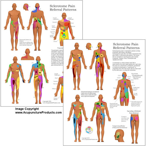 Sclerotome / Visceral Pain Referral Poster - Clinical Charts and Supplies