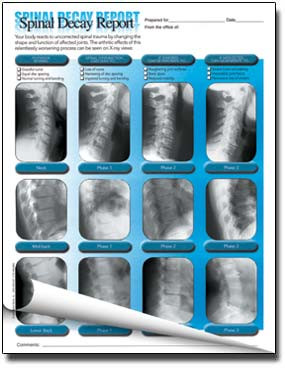 Spinal Decay Report Insert - Clinical Charts and Supplies