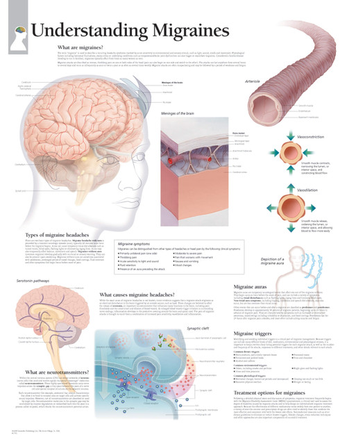 Migraine Poster - Clinical Charts and Supplies
