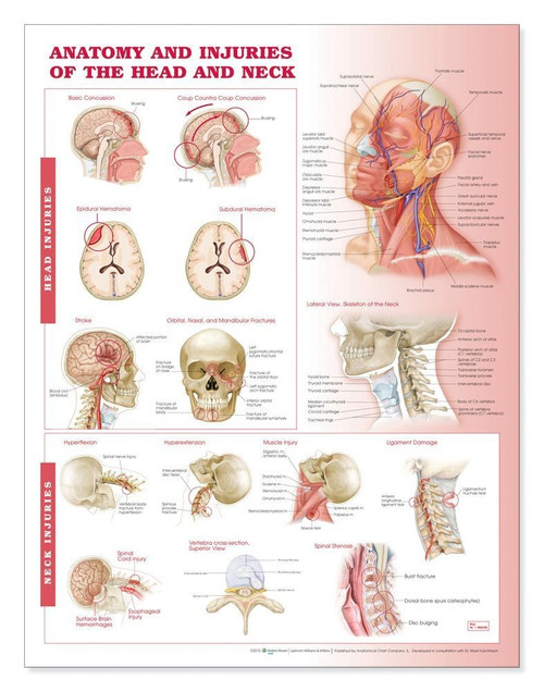Head And Neck Injuries Anatomy Poster - Clinical Charts and Supplies