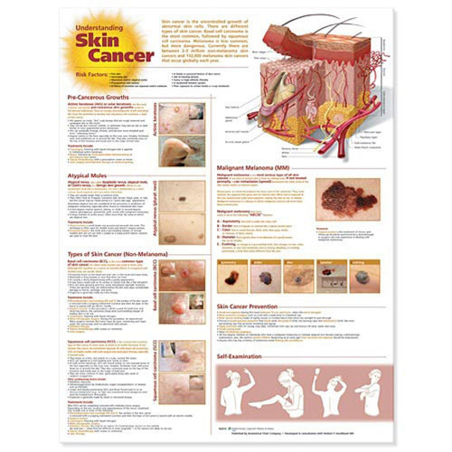Skin Cancer Poster 2nd Ed. - Clinical Charts and Supplies