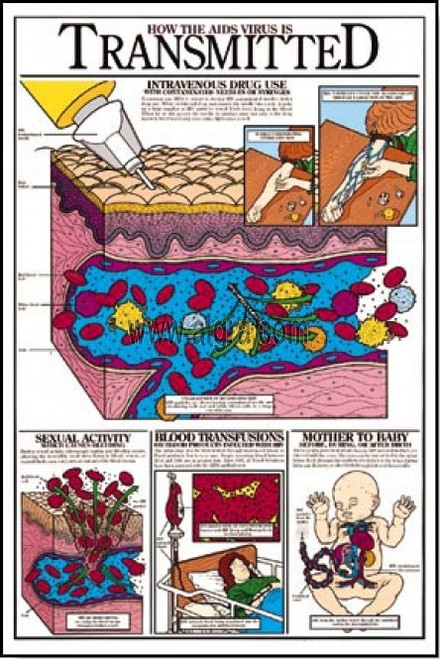 How the Aids Virus is Transmitted Grades 5-9 - Clinical Charts and Supplies