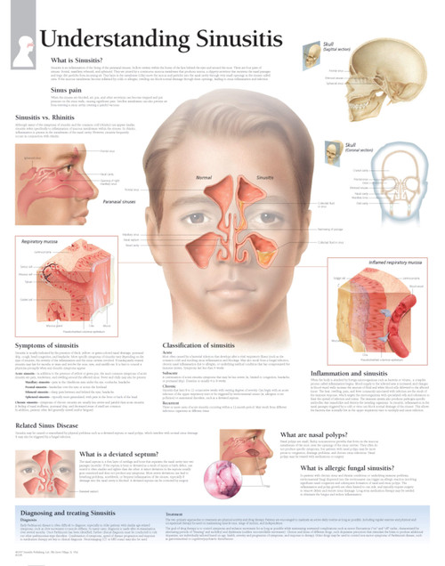 Sinusitis Poster - Clinical Charts and Supplies