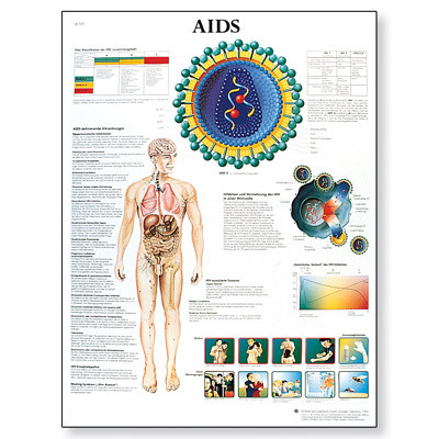 AIDS Chart - Clinical Charts and Supplies