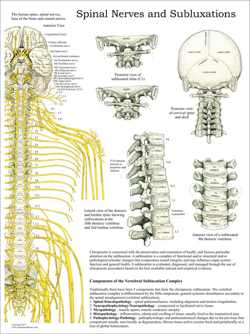Chiropractic Subluxation Complex - Clinical Charts and Supplies