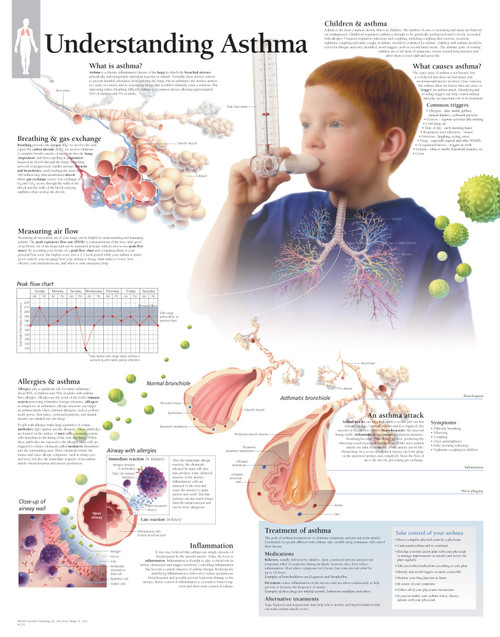 Asthma Poster - Clinical Charts and Supplies