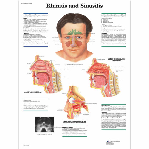 Anatomy Posters and Charts-Ears, Eyes, Nose, Throat