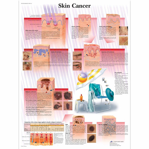 Skin Cancer Anatomical Poster - Clinical Charts and Supplies