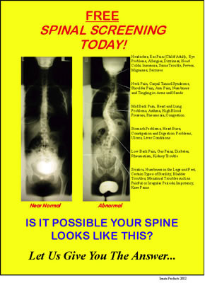 Subluxation Spinal Screening Poster (Larger version) - Clinical Charts ...