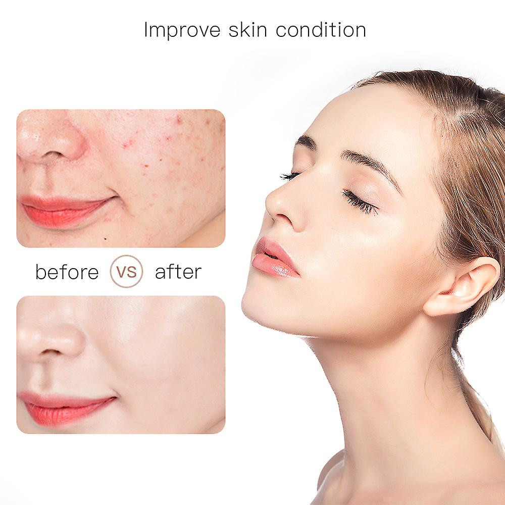 Nano Needle wireless LED Electric Derma pen Promotes Osmosis, Collagen ...