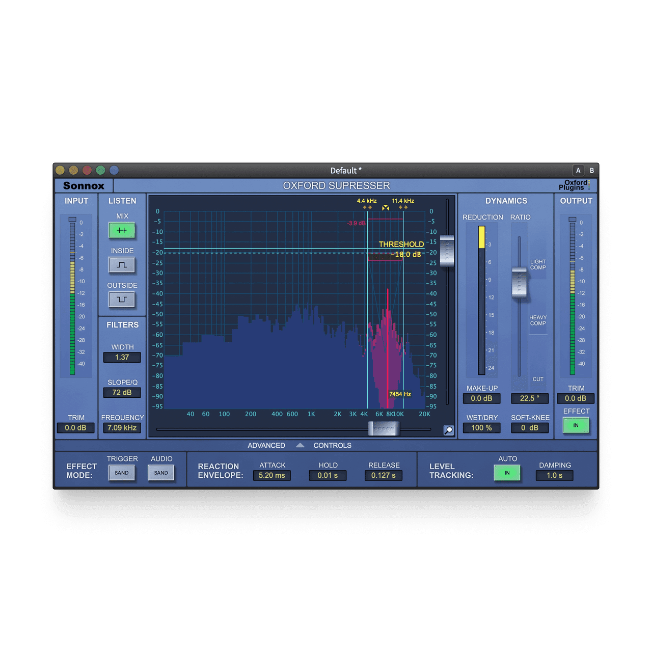 Elite Bundle | Sonnox