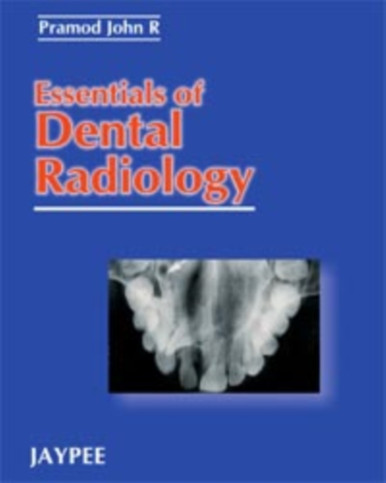 Essentials of Dental Radiology - John R Pramod (Author) - 9788171796700 ...
