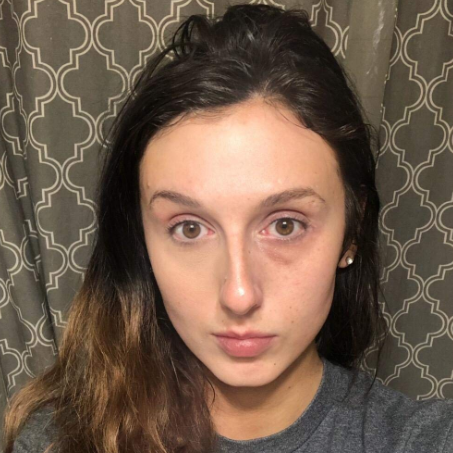 Wide Awake Dark Circle Concealer for Sensitive Skin
