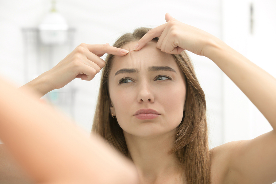 Acne and Self-Esteem: What the Research Says - Sheer Miracle