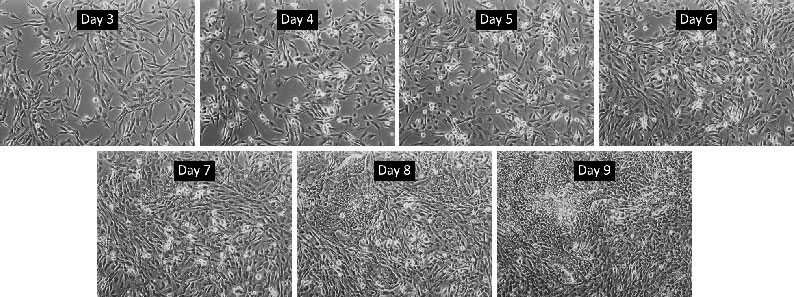 Custom iPSC Generation