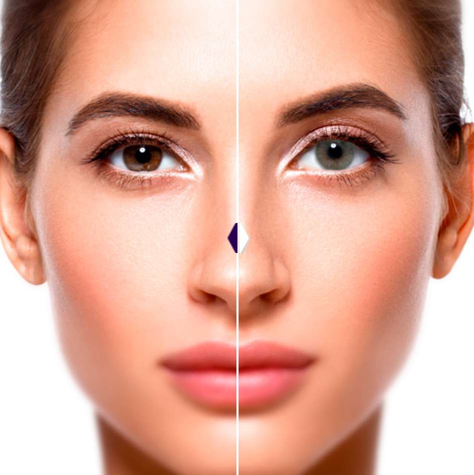 Solotica Hidrocor Rio Copacabana Yearly Lenses
