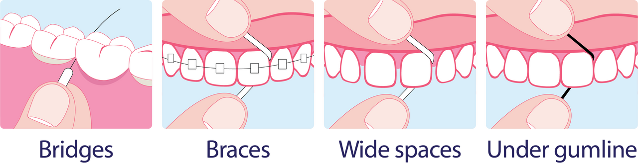 Piksters Z Floss 50 Pack | Erskine Dental