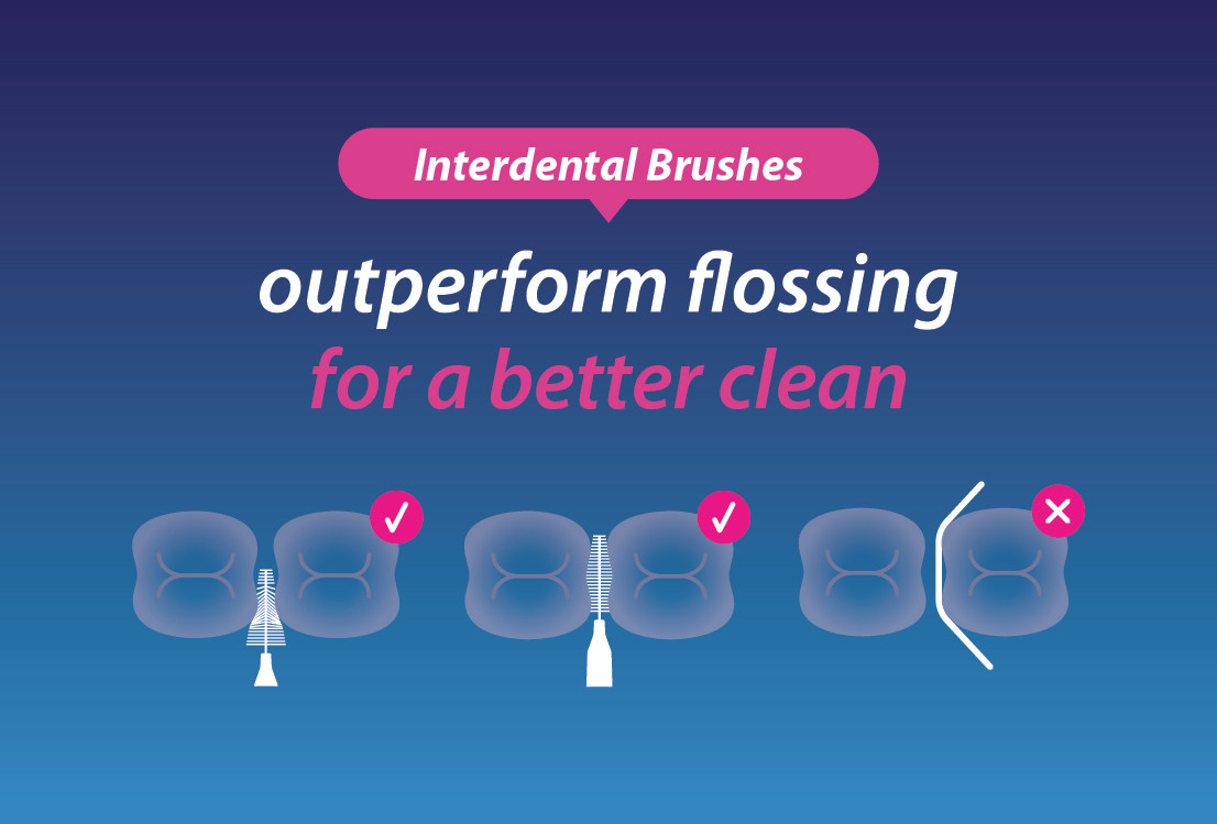 Interdental Brushes v. String Floss: What the Science Really Says ...