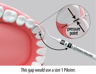 Interdental Brush Gap Probe | Erskine Dental