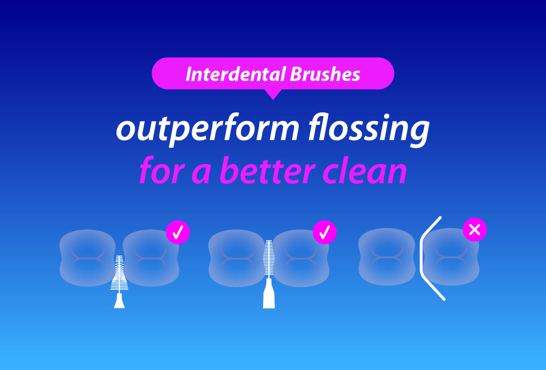 Interdental Brushes v. String Floss: What the Science Really Says ...