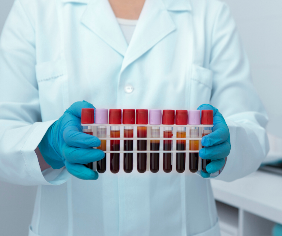 The Cornerstone of Hematology: Why Wright-Giemsa Stain Matters - ENG ...