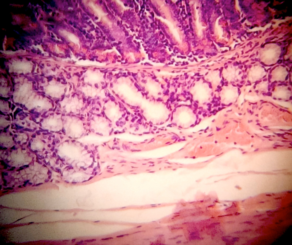 Enhancing Gram Stain Reliability: Techniques to Prevent Gram-Negative ...