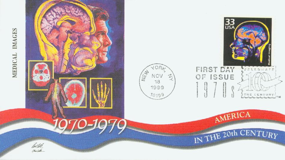 3189o - 1999 33c Celebrate the Century - 1970s: Medical Imaging ...