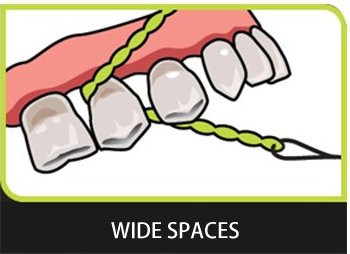 Idontix X-Floss Lite Easy Bridge and Implant Floss